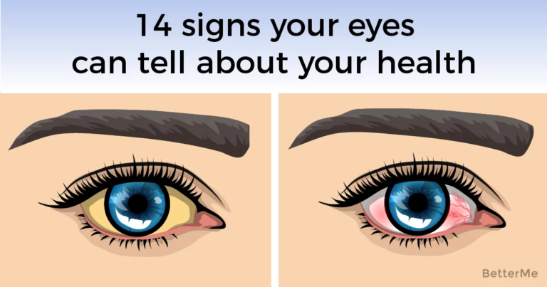 14 Things Your Eyes are Trying to Tell You About Your Health - Overdose ...